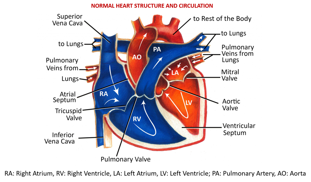 Heart Defects Present at Birth - Congenital Heart Defects
