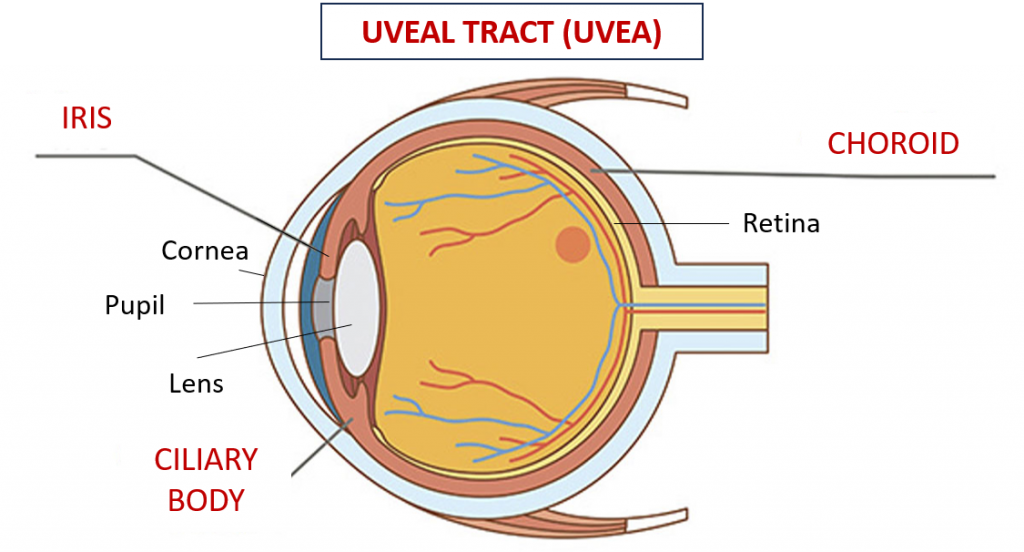 Uveitis - 5 Important Points of Understanding